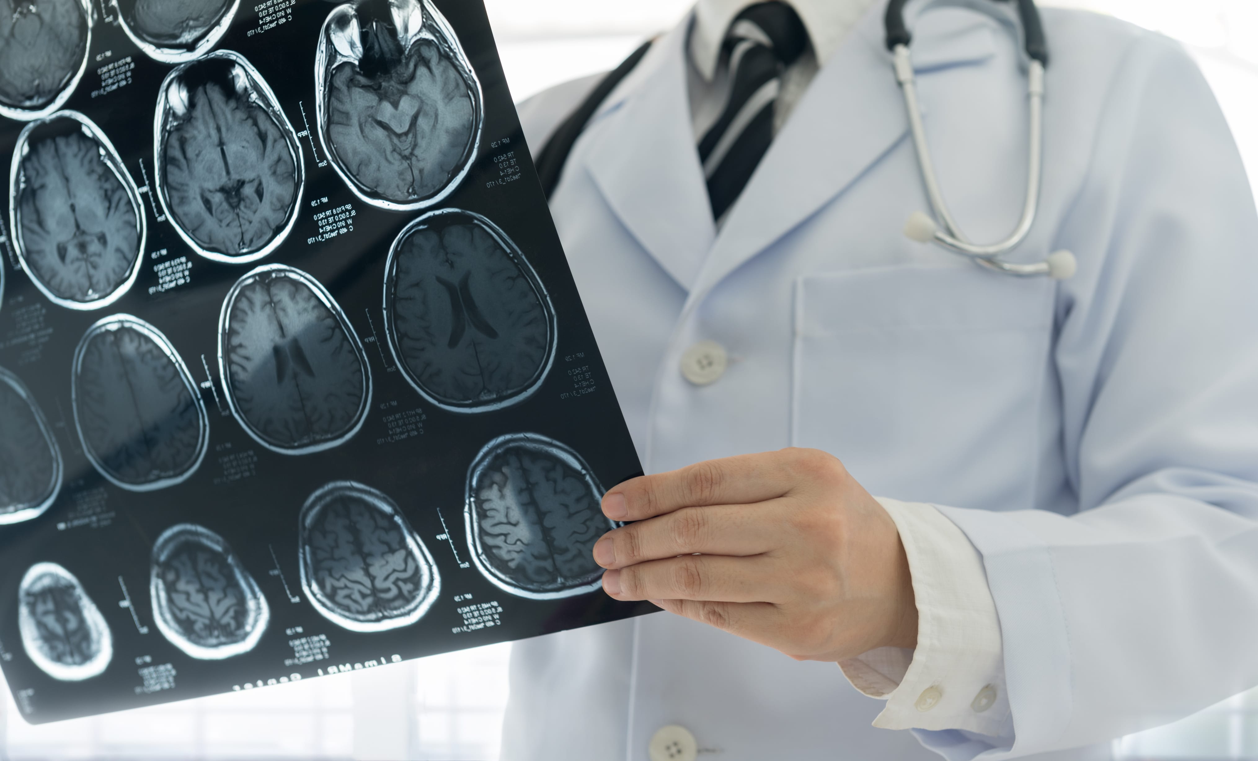 Visualase Recall Class Action Lawsuit | Medtronic Visualase Laser Lawyer